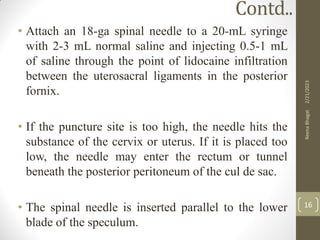 culdocentesis.pdf