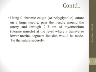 culdocentesis.pdf