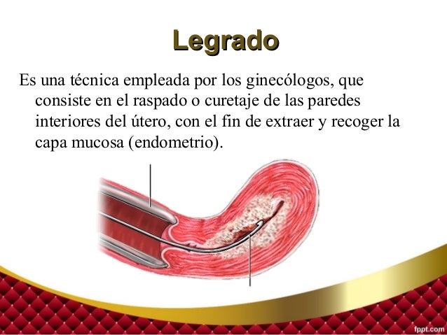 Culdocentesis y legrado