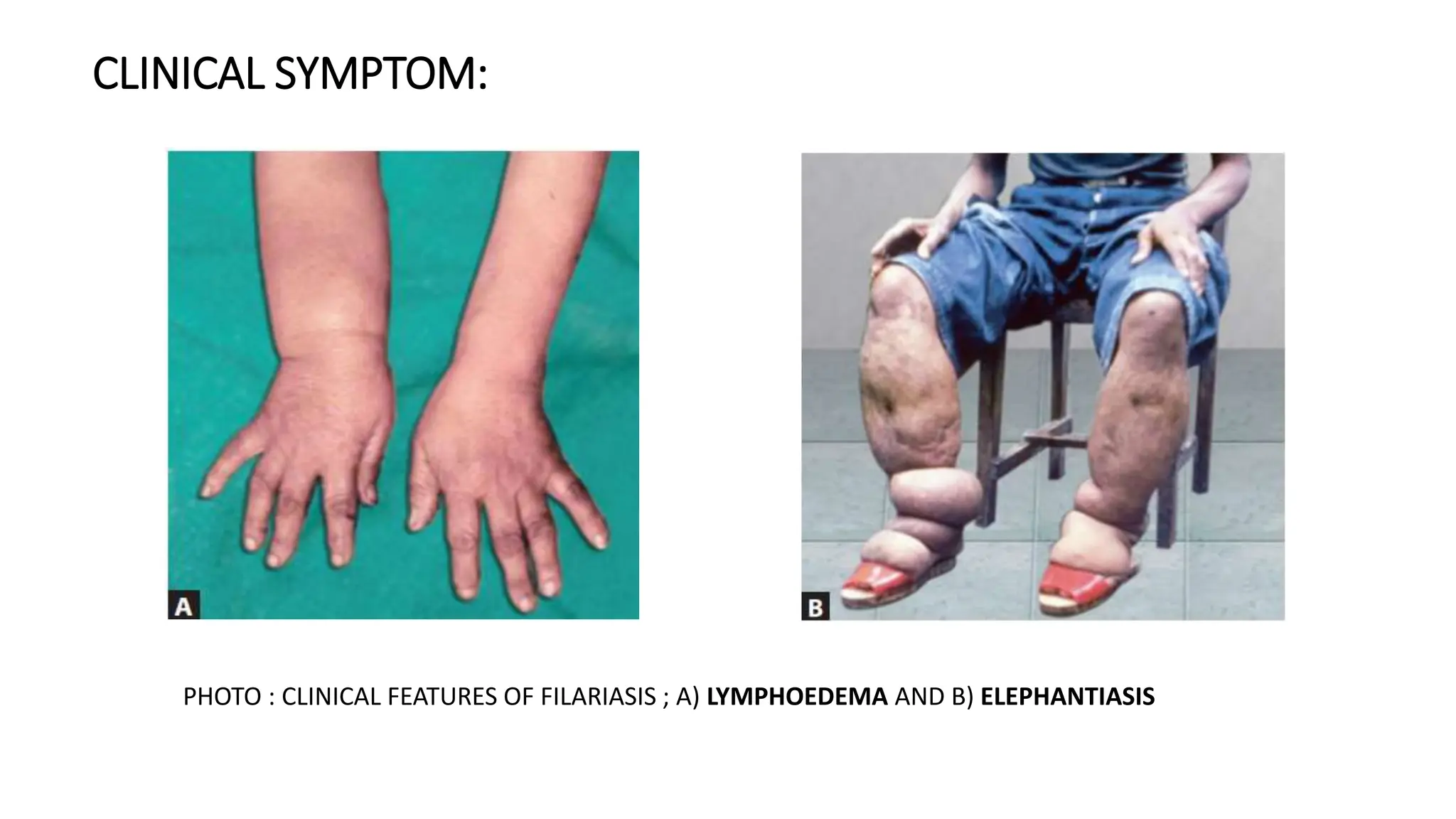 CULEX MOSQUITOES, SYSTEMATIC CLASSIFICATION, MORPHOLOGY, LIFE CYCLE ...