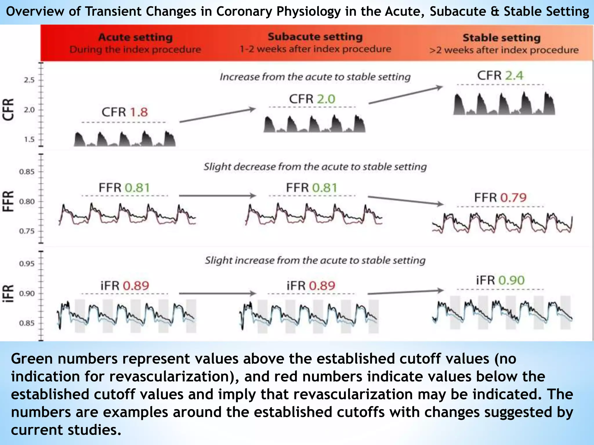 Culprit versus Nonculprit Vessel revascularisation in STEMI- Recent.pptx