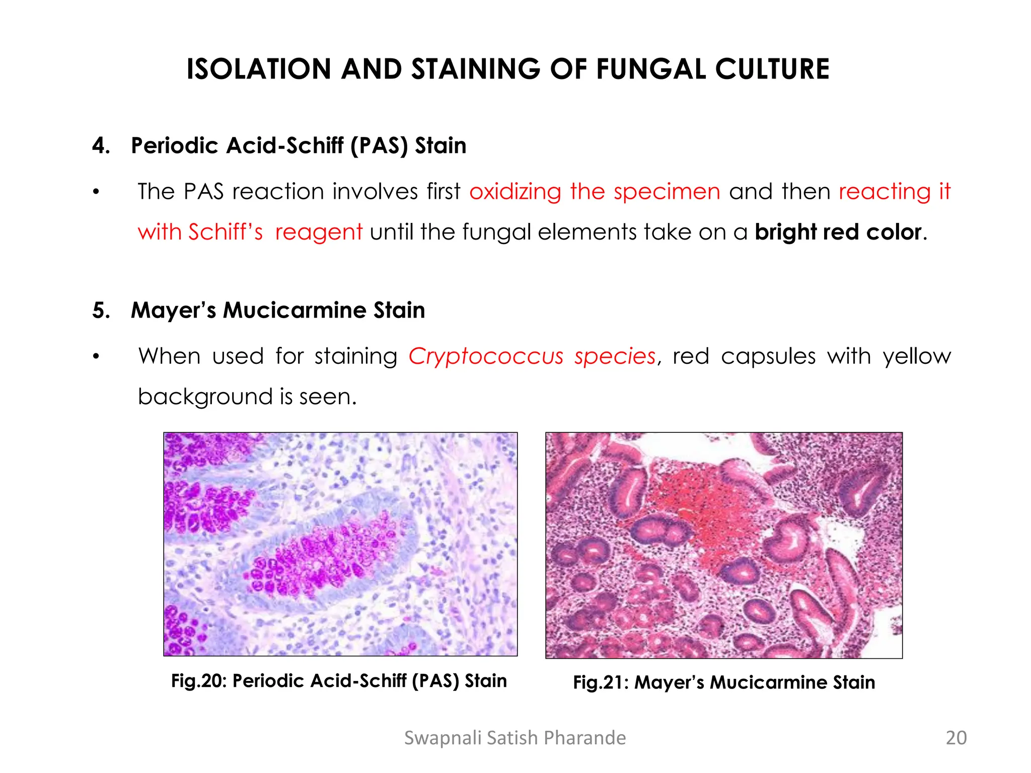 Cultivation,Isolation and Staining of Fungal Culture.pdf