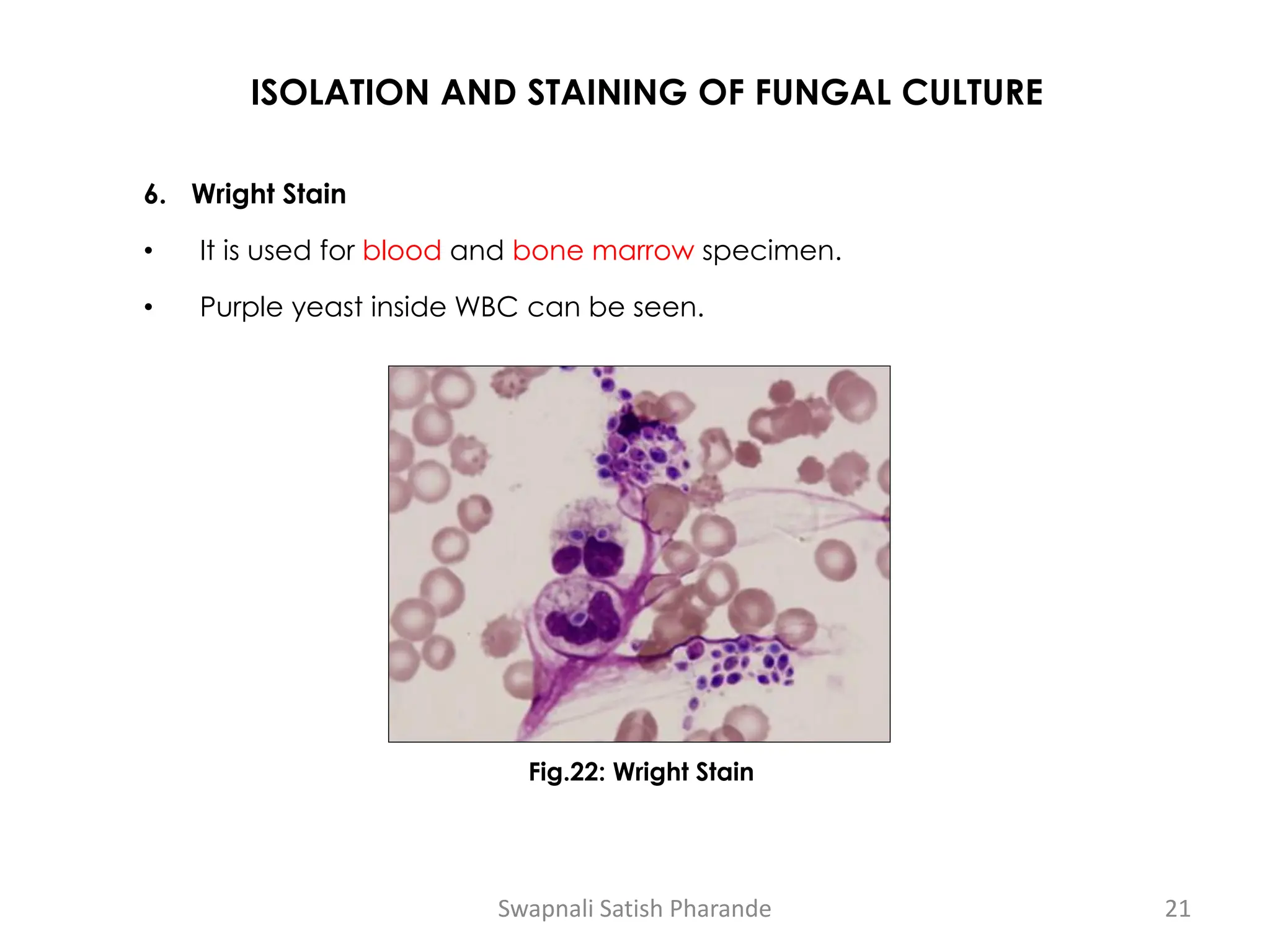 Cultivation,Isolation and Staining of Fungal Culture.pdf
