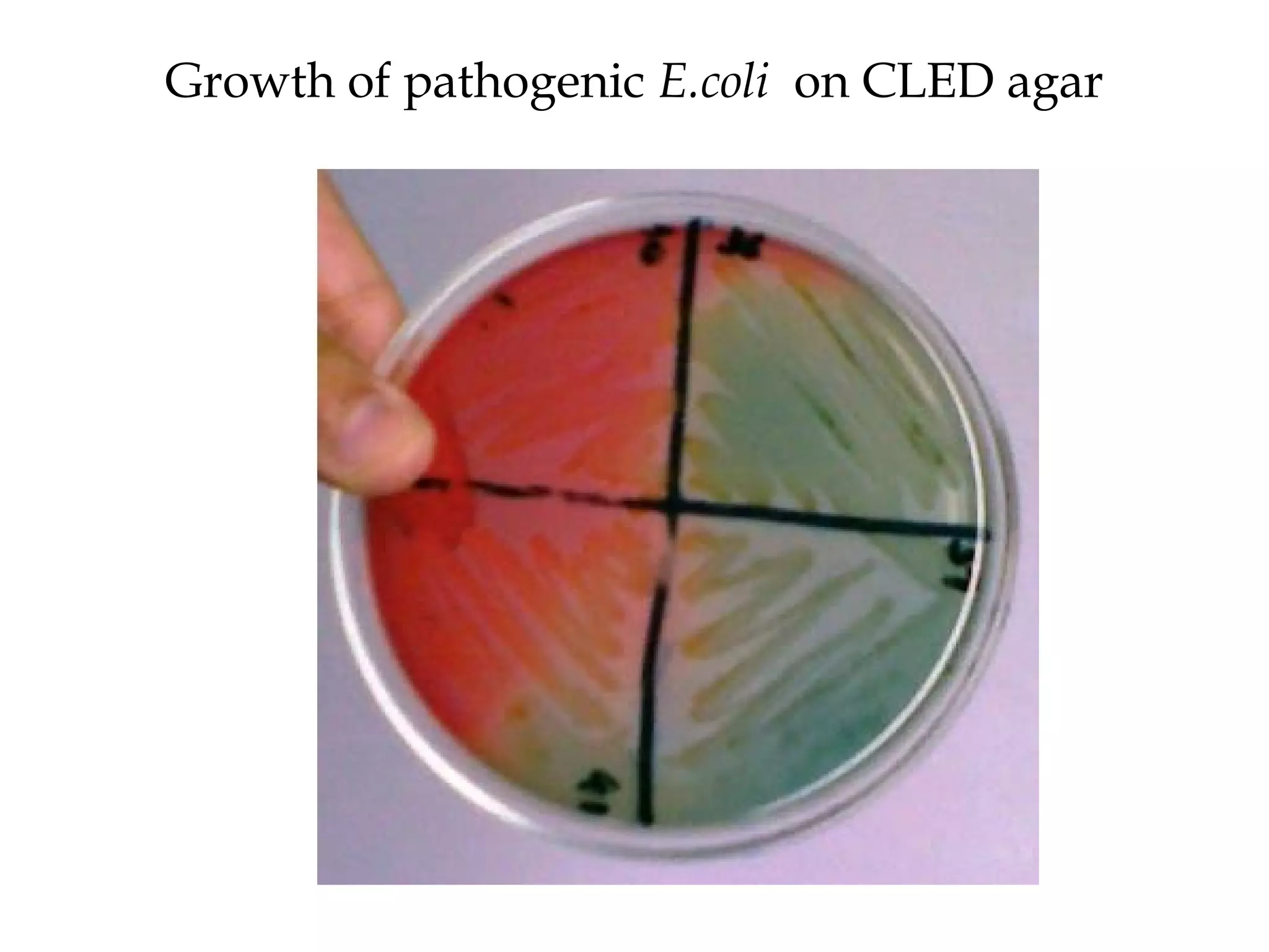 Cultivation of bacteria and culture methods | PPT