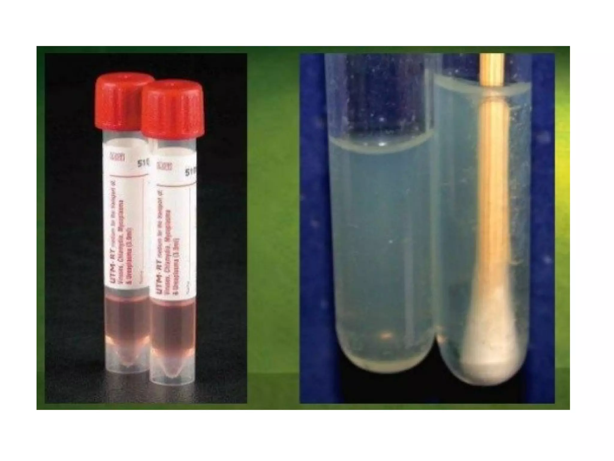 Cultivation of bacteria and culture methods | PPT