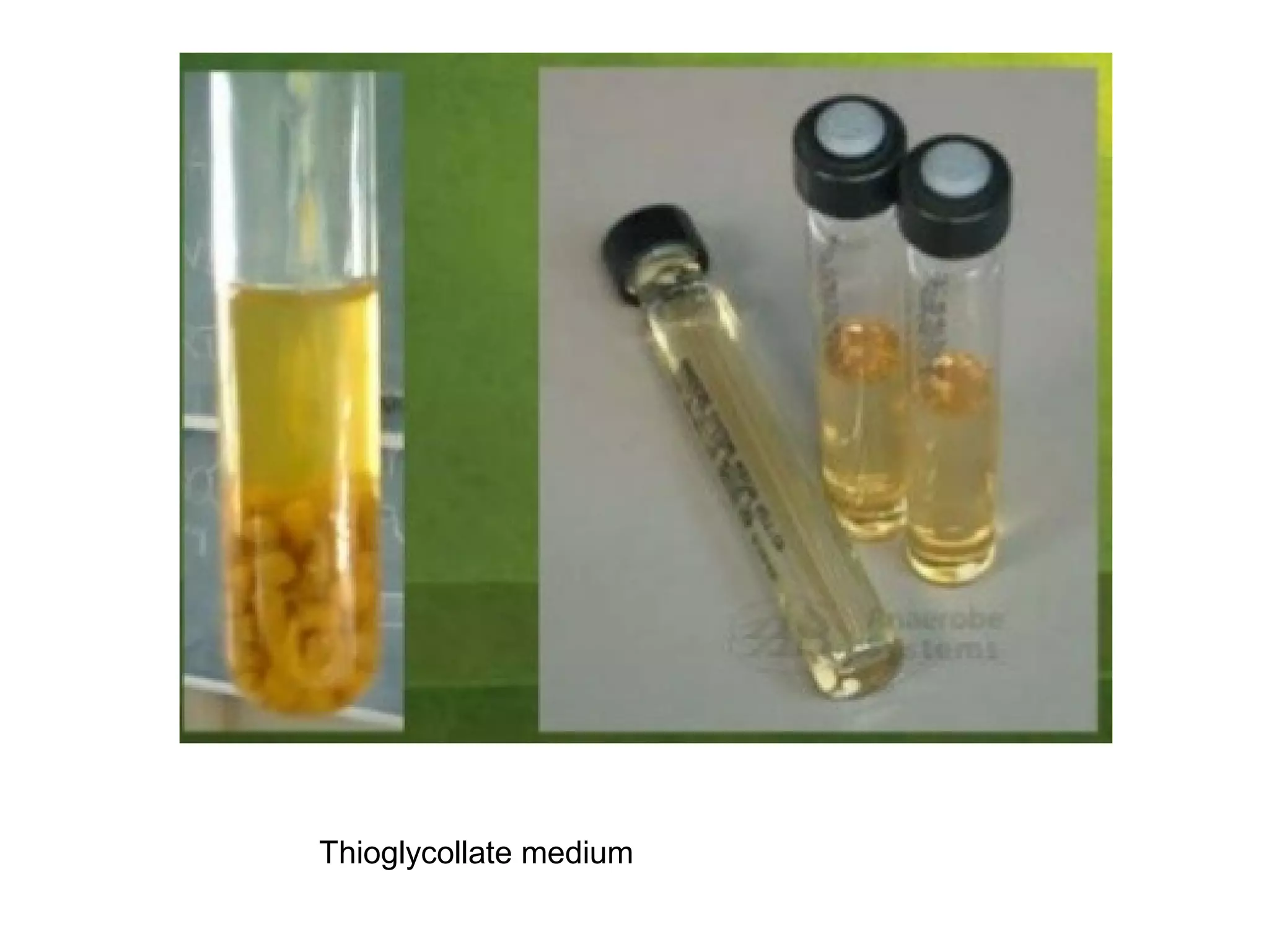 Cultivation of bacteria and culture methods | PPT