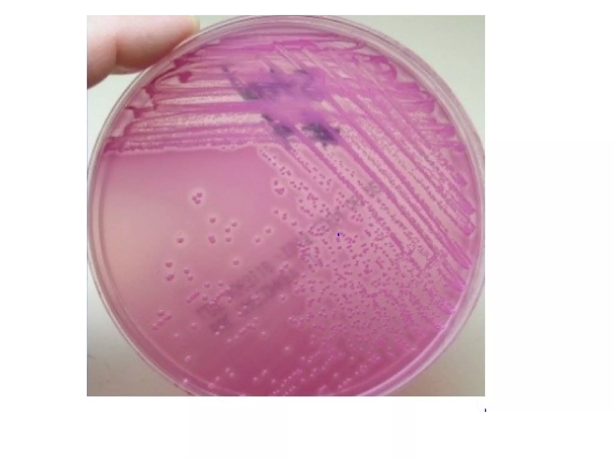 Cultivation of bacteria and culture methods | PPT