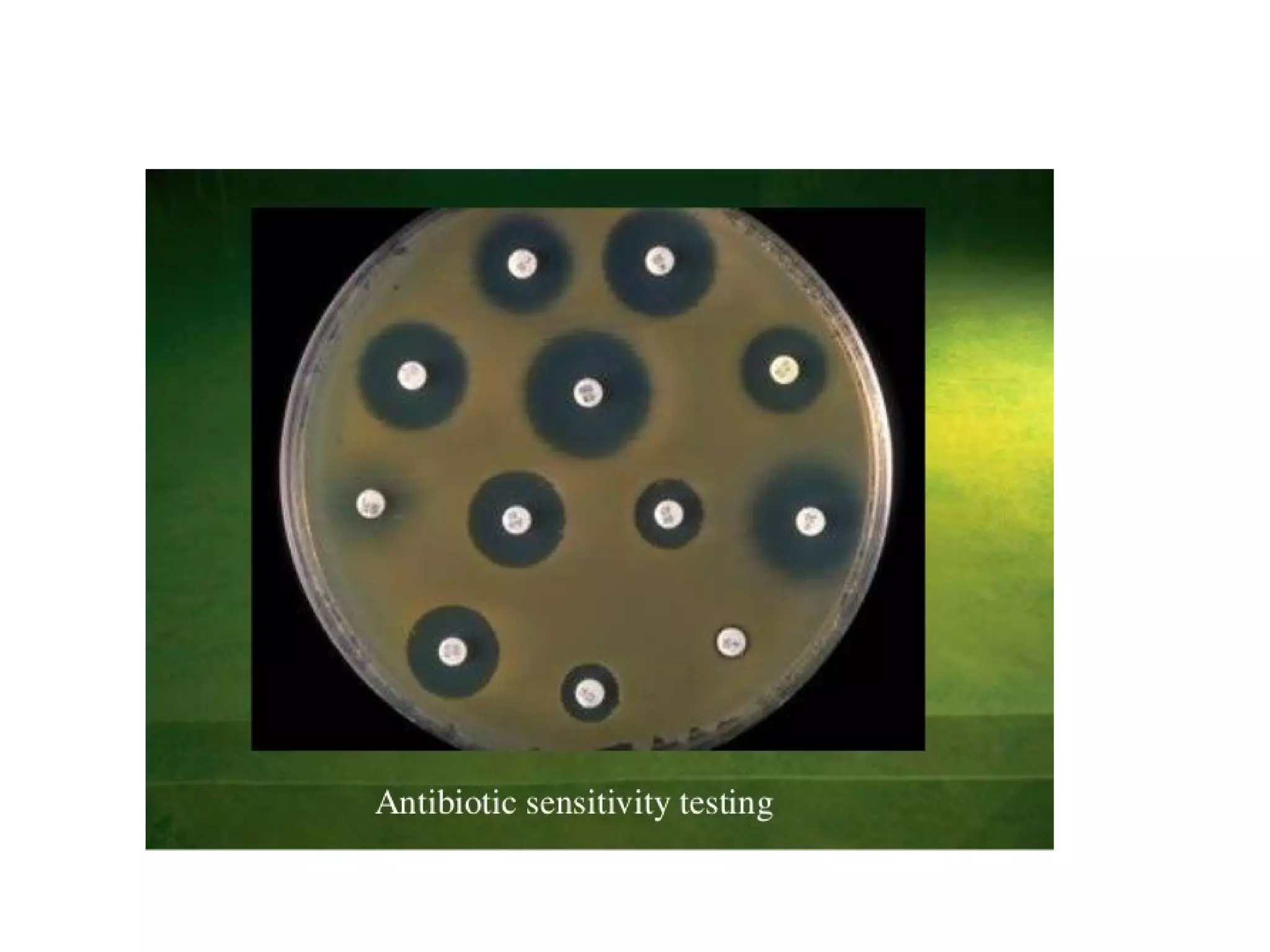 Cultivation of bacteria and culture methods | PPT