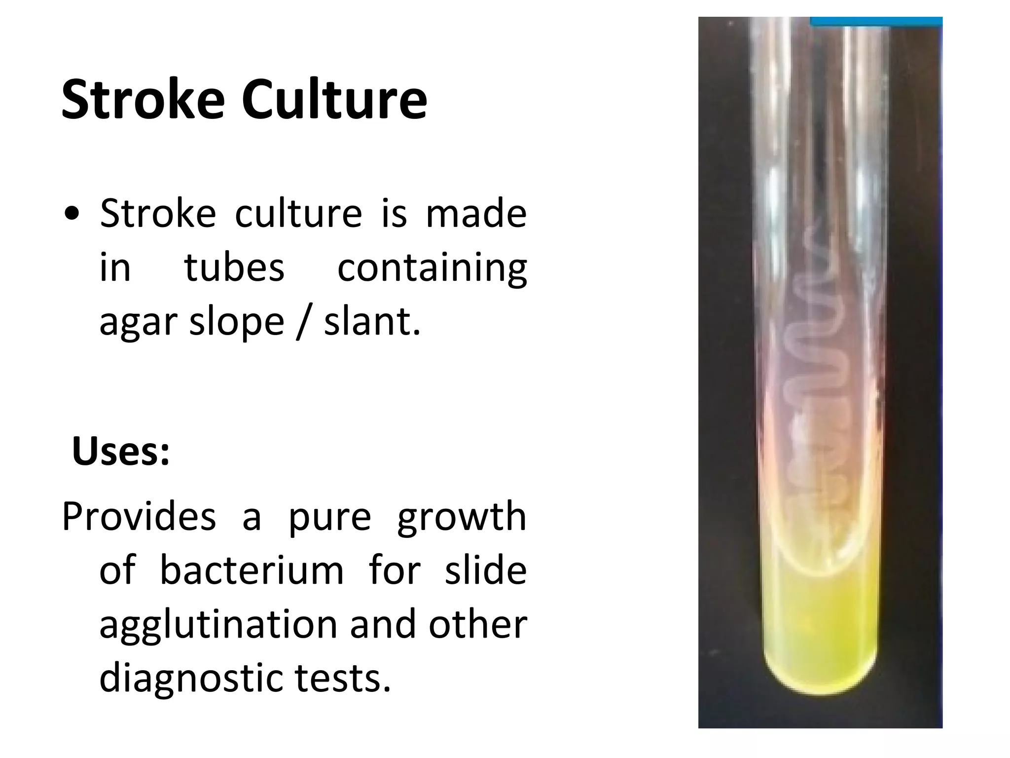 Cultivation of bacteria and culture methods | PPT