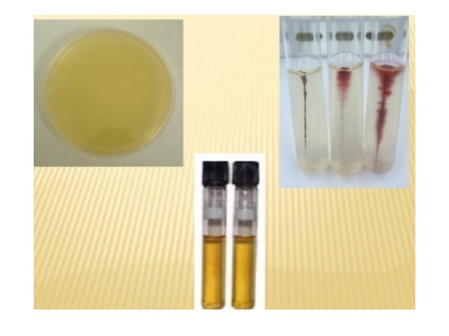 Cultivation of bacteria and culture methods | PPT | Biological Sciences ...