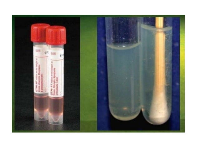 Cultivation of bacteria and culture methods | PPT | Biological Sciences ...