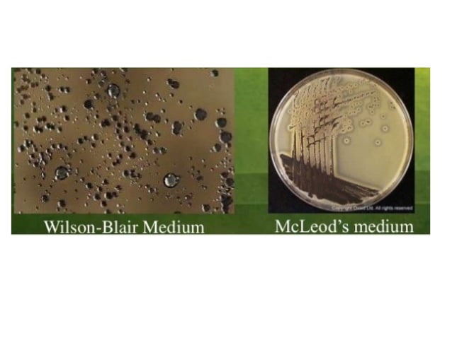 Cultivation of bacteria and culture methods | PPT | Biological Sciences ...