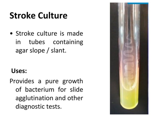 Cultivation of bacteria and culture methods | PPT | Biological Sciences ...