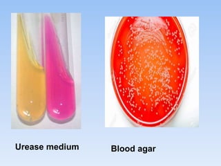 cultivation techniques in Microbiology.pptx