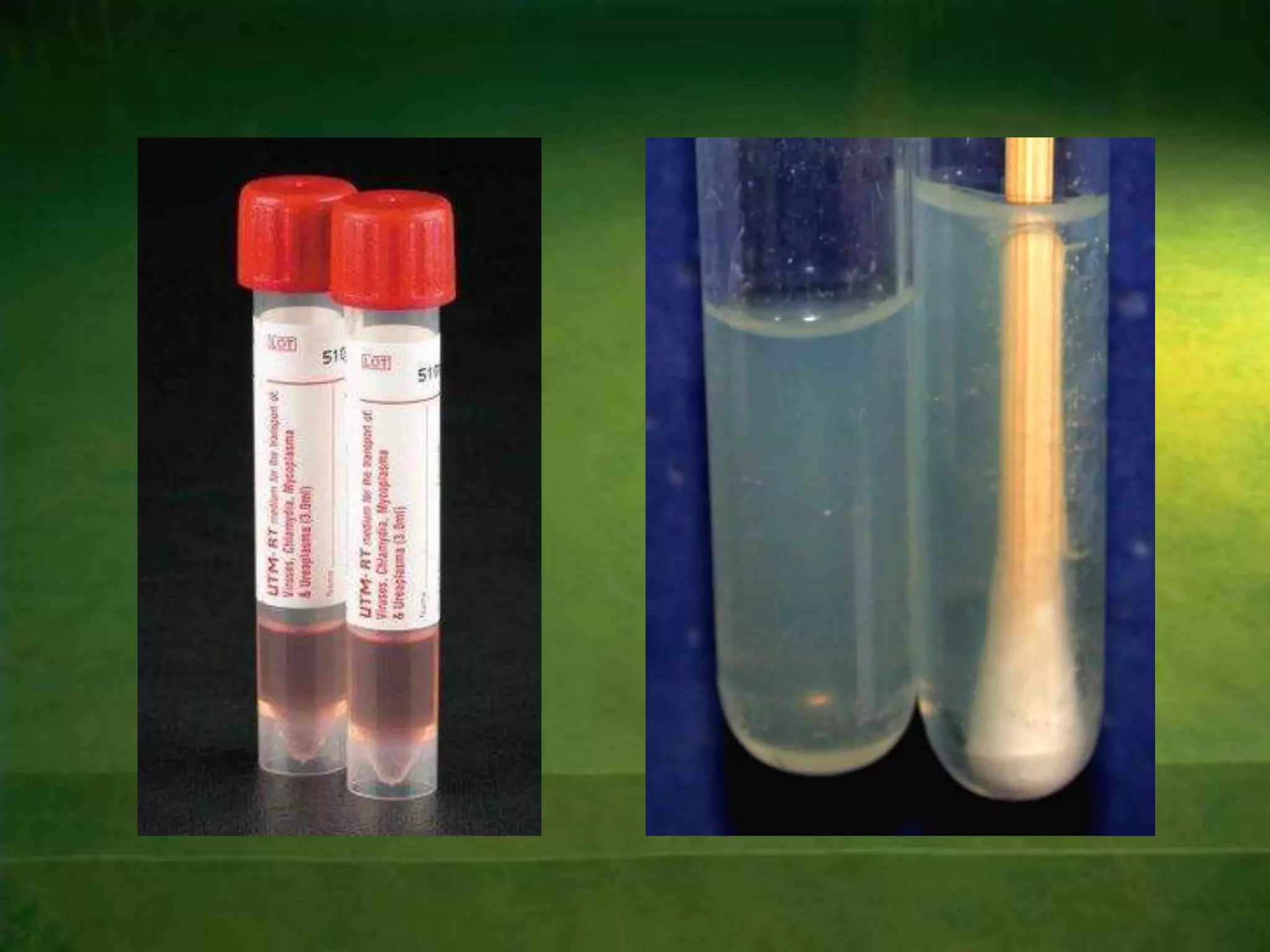 Culture media & methods | PPSX