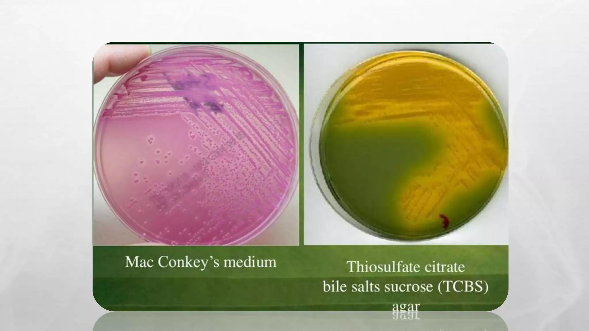 types of culture media | PPTX
