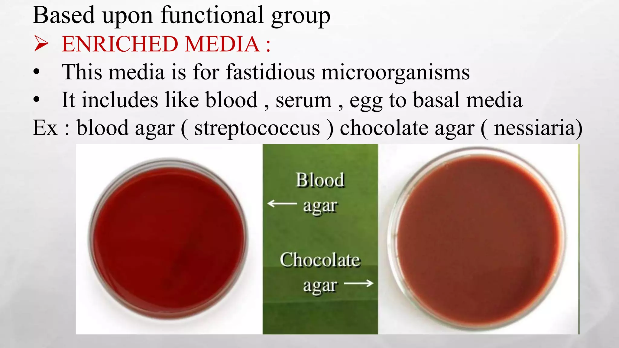 types of culture media | PPTX