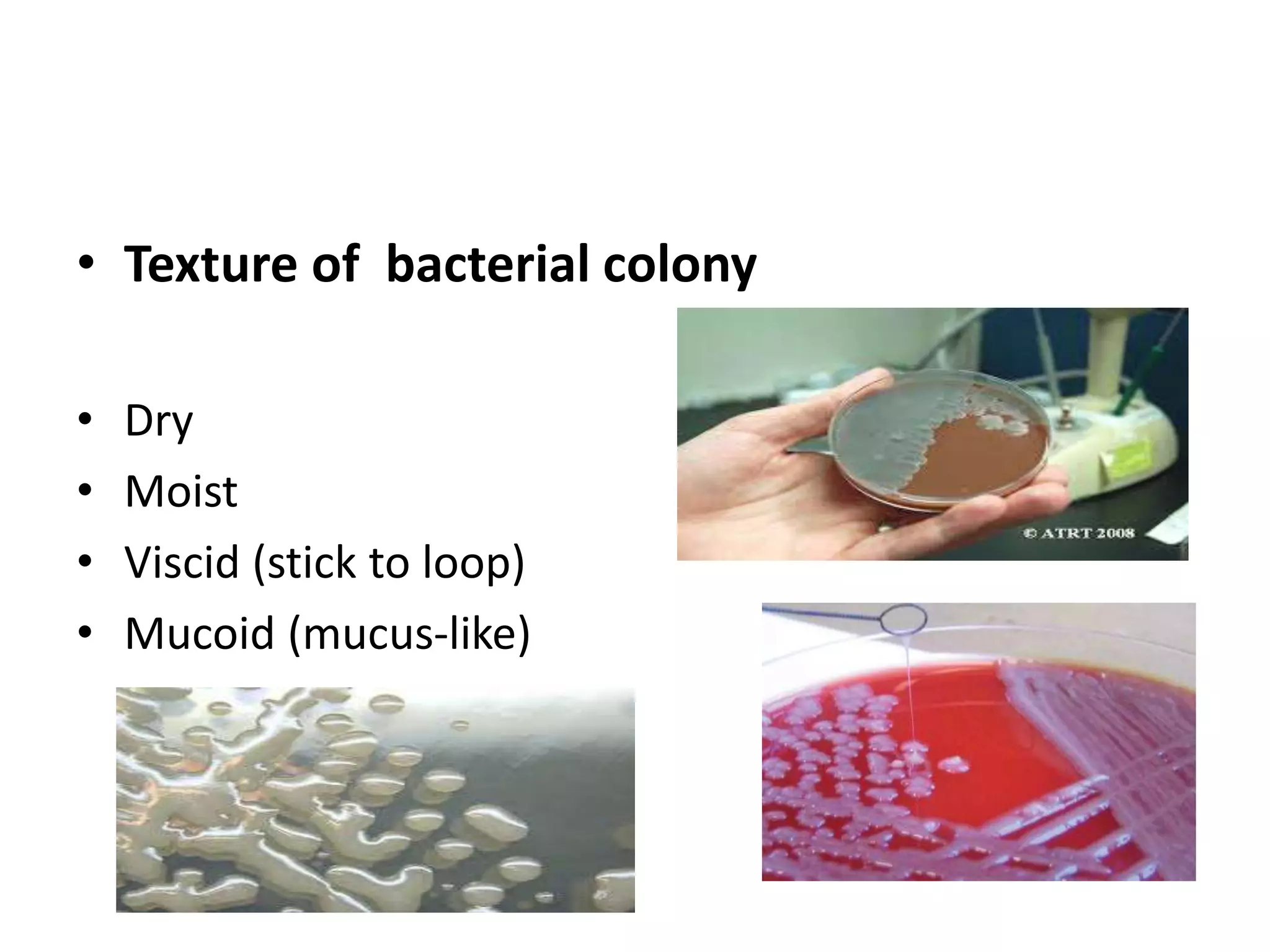 Culture characteristics of bacteria | PPTX