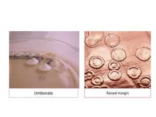 Culture characteristics of bacteria | PPTX