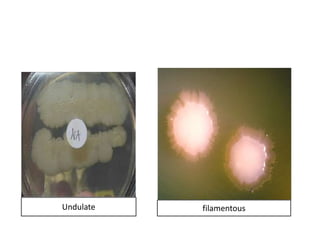 Culture characteristics of bacteria | PPTX