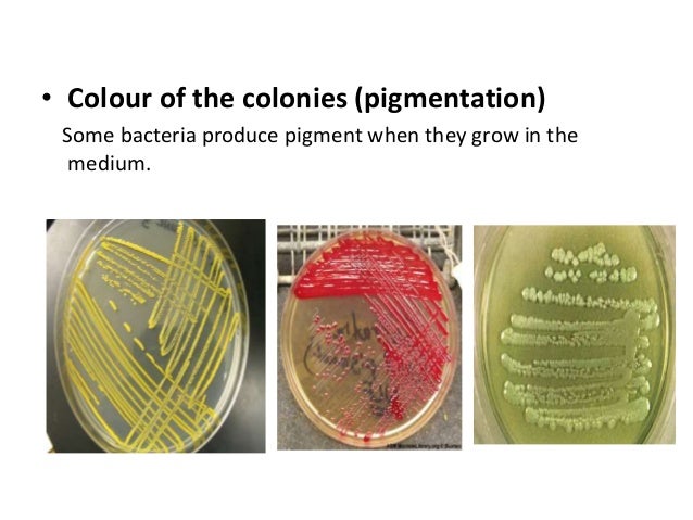 Culture characteristic of bacteria