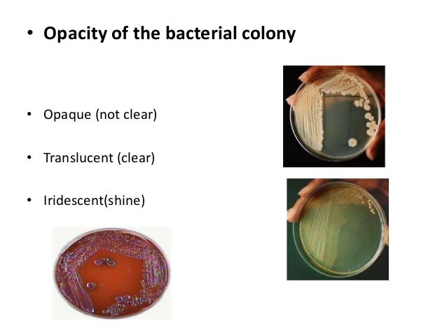 Culture characteristic of bacteria