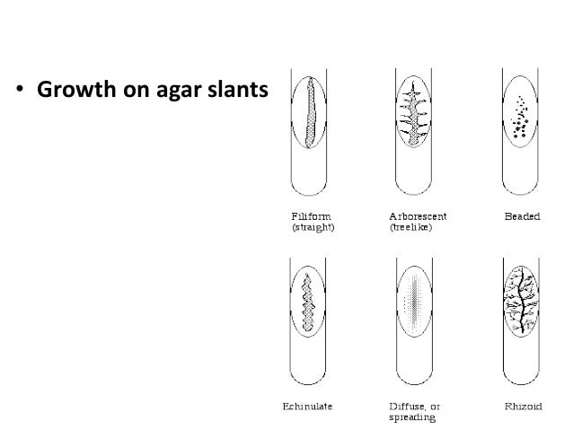 Culture characteristic of bacteria