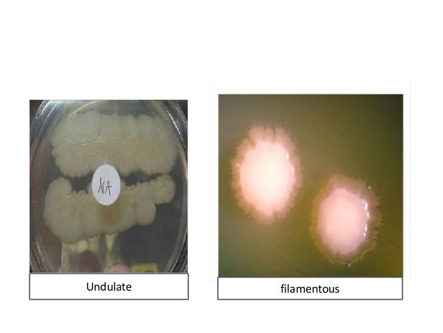 Culture Characteristic Of Bacteria