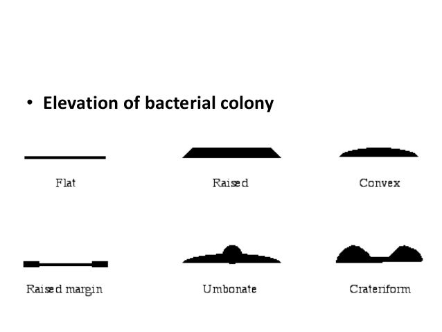 Culture characteristic of bacteria