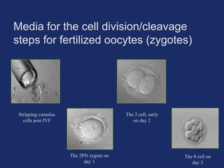 Culture media for IVF: which to choose? | PPTX