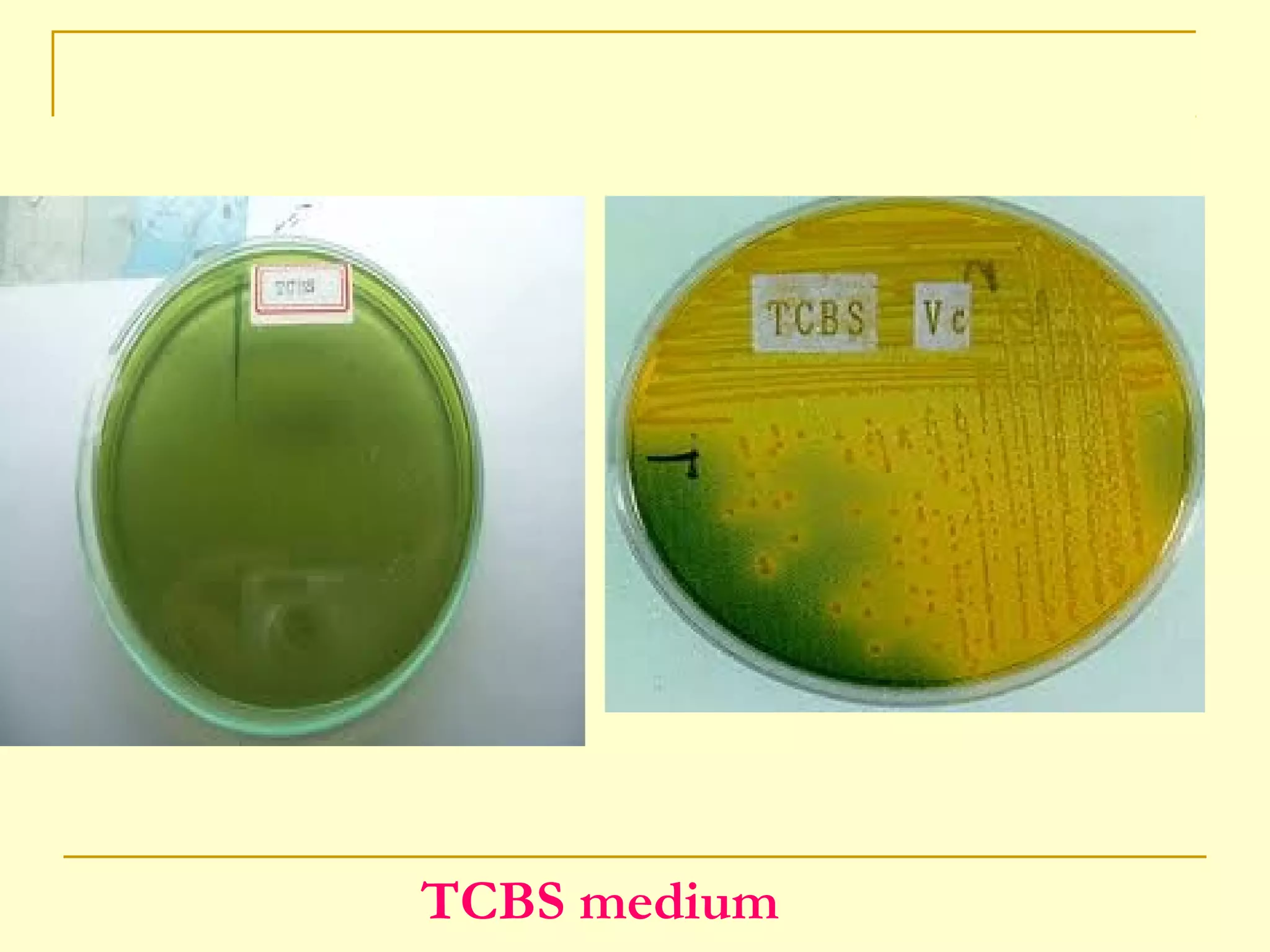 Bacterial Culture media | PPT