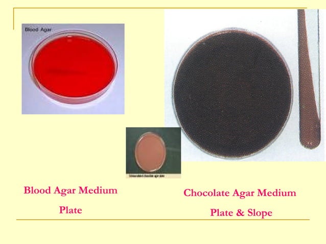Bacterial Culture media | PPT