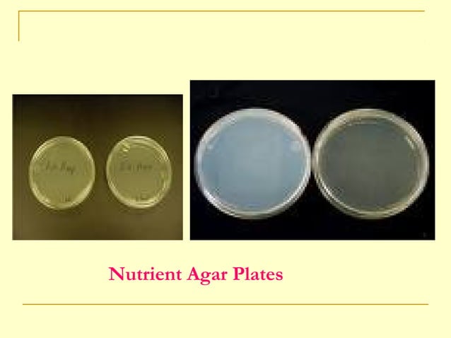 Bacterial Culture media | PPT