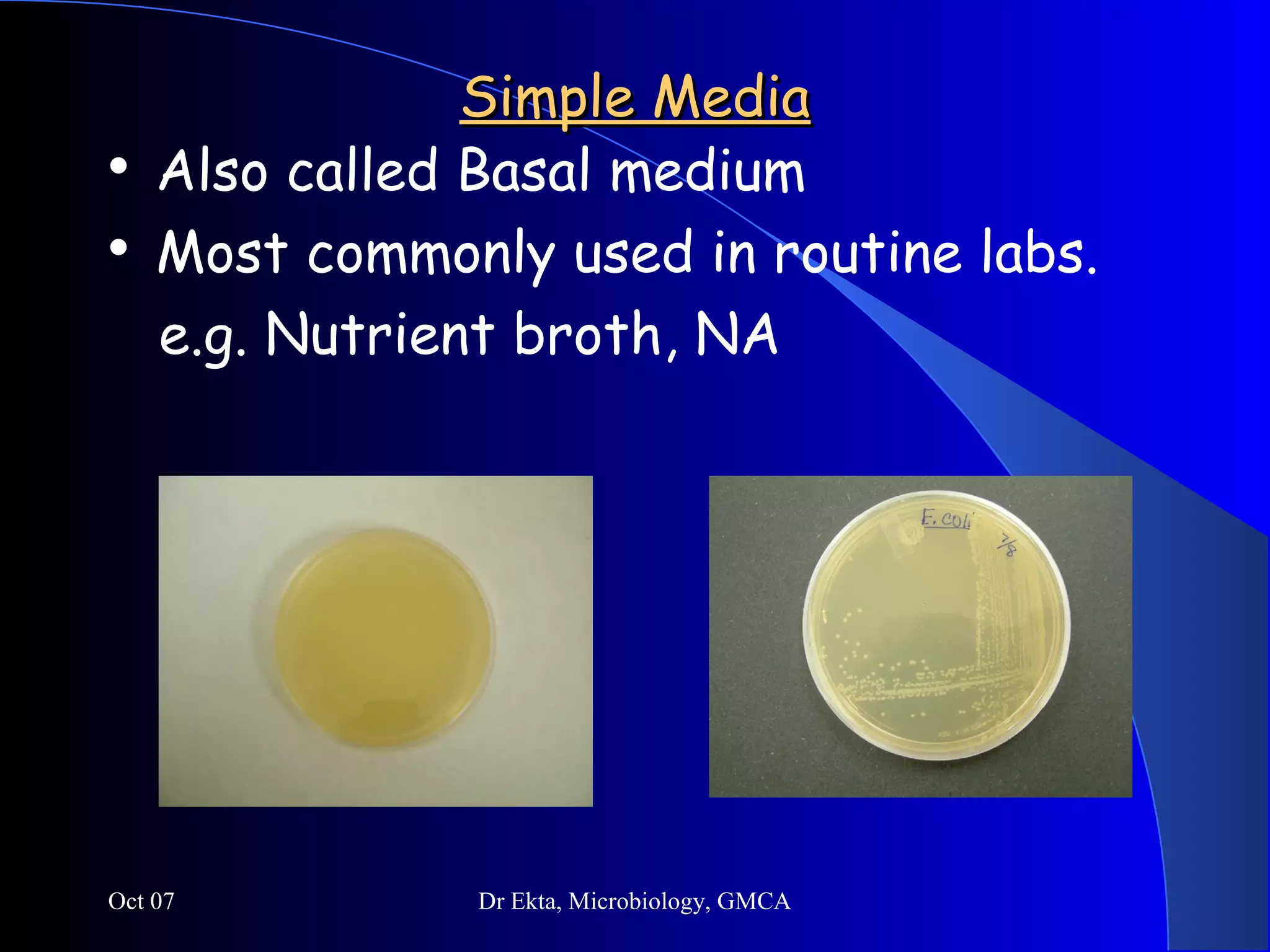 Types of Culture media | PPT