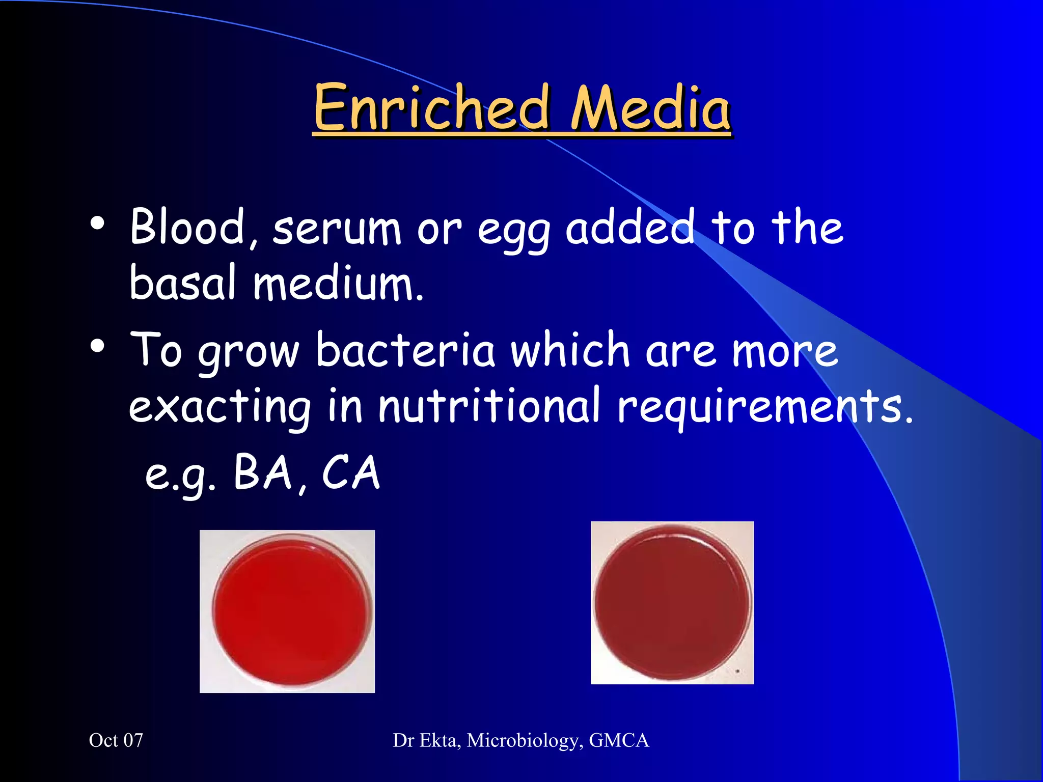 Types of Culture media | PPT