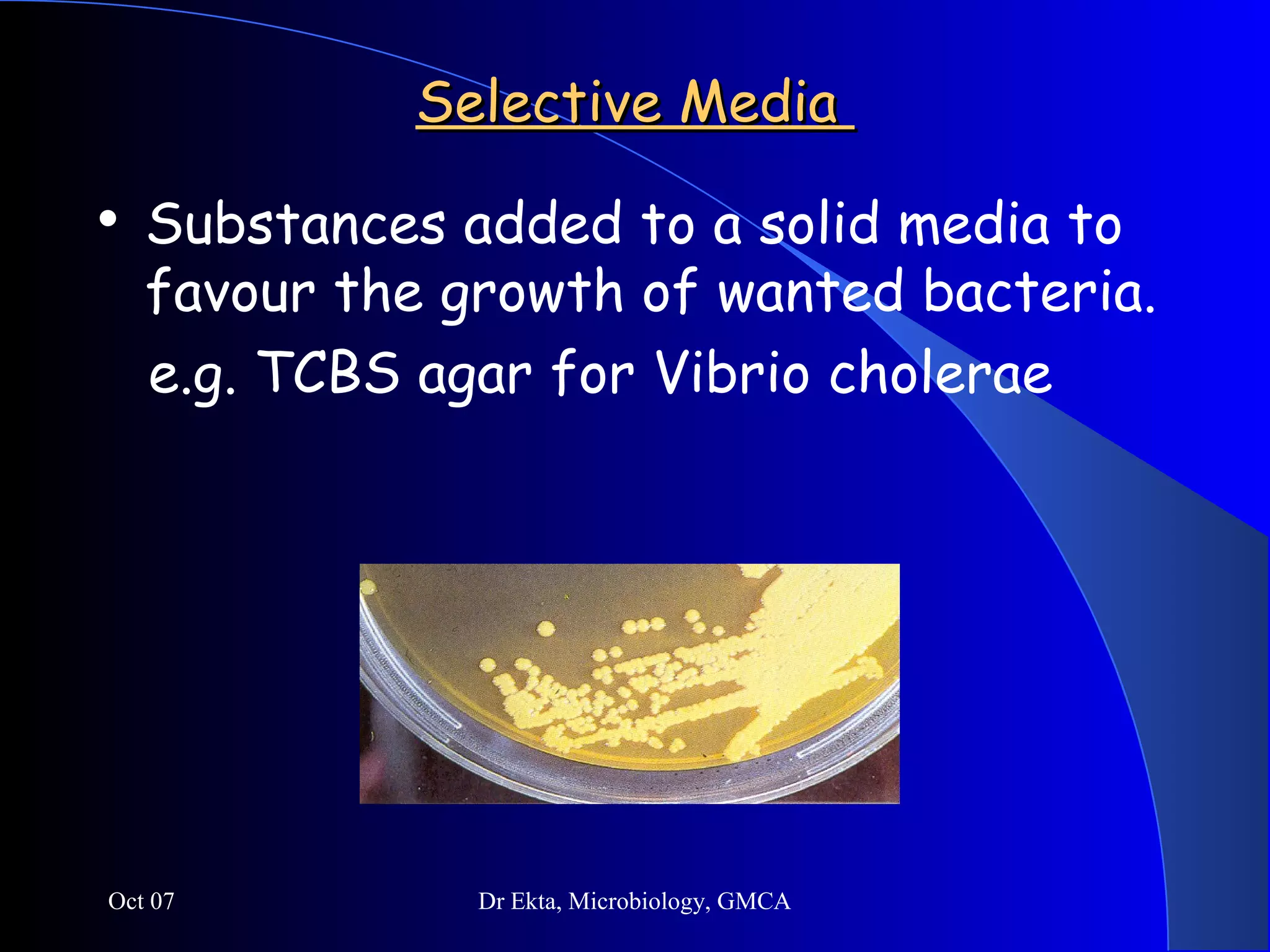 Types of Culture media | PPT