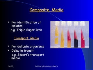 Types of Culture media | PPT