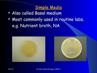 Types of Culture media | PPT