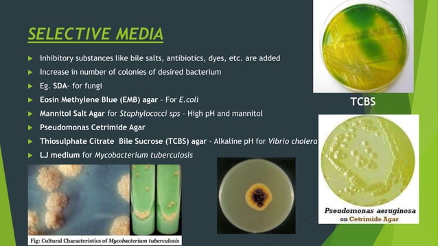 Culture media & Quality Control | PPTX