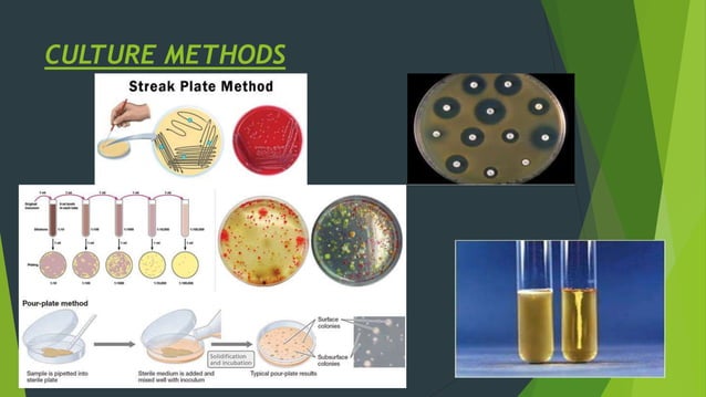 Culture media & Quality Control | PPTX