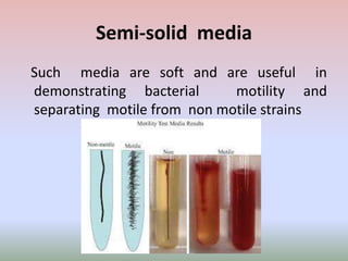 Culture media | PPTX