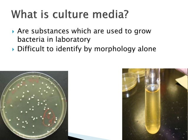 culture media.ppt