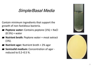 CULTURE MEDIA.pptx | Blood Disorders | Diseases and Conditions