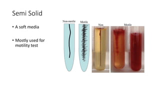 Culture media.pptxjhkbmnbjbnbvnvnbvjhnbb | PPT