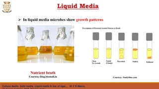 Culture media solid, liquid, use of agar | PPTX