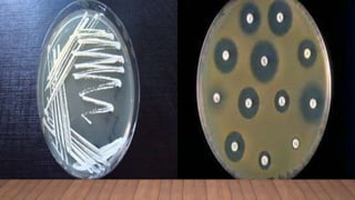 Culture media and culture methods | PPTX