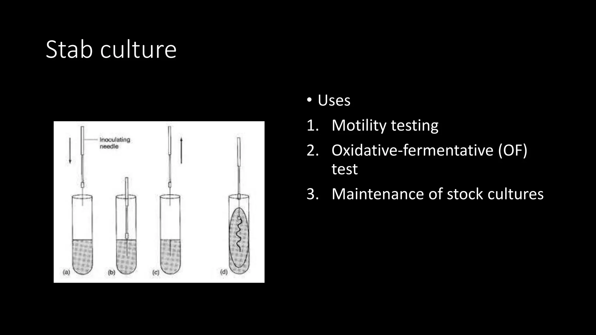 Culture media and methods by Dr. Himanshu Khatri | PPTX