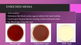 Culture media and Culture methods | PPTX