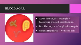 Culture media and Culture methods | PPTX