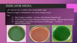 Culture media and Culture methods | PPTX